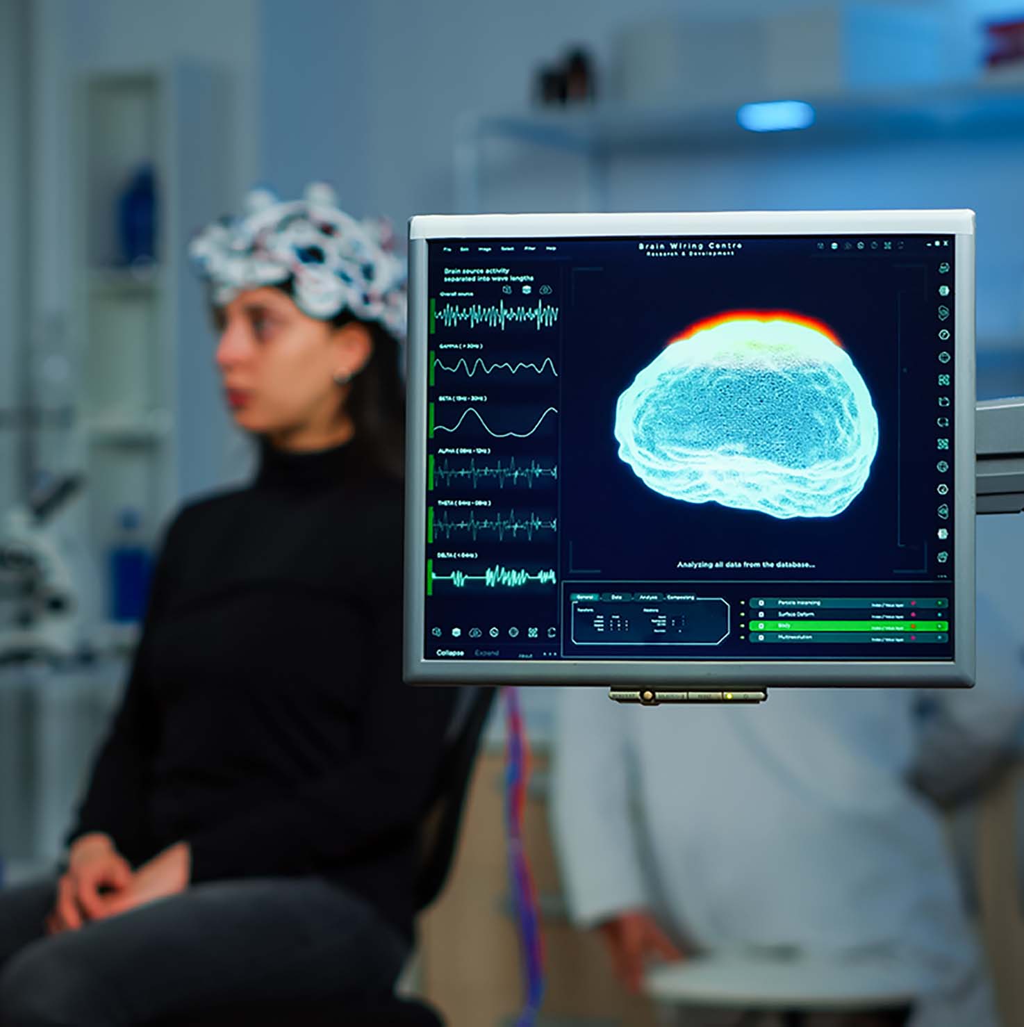 Télé interprétation des EEG | Marché actif | 2024 - 2028