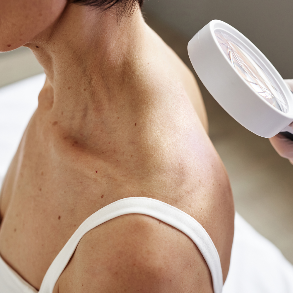 Némolizumab NEMLUVIO | Marché actif | 2025 - 2027